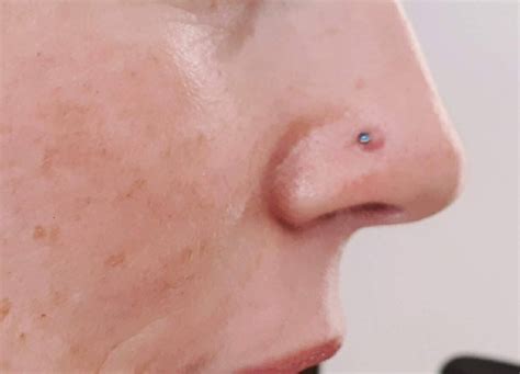 Ahora Premisa Subdividir Pomada Para Granuloma Piercing Viudo Foso