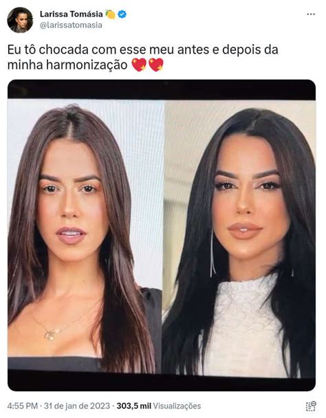 Ex Bbb Larissa Tom Sia Surpreende Antes E Depois Tudo Pop