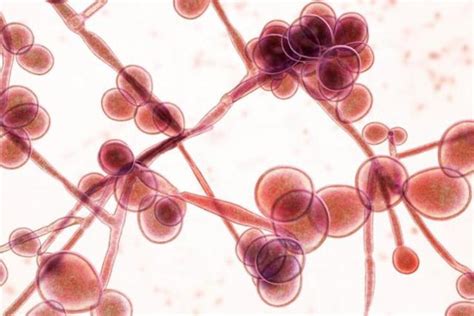 Candida auris qué es cómo se contagia cuáles son los síntomas y qué