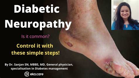 Diabetic Neuropathy Foot Pain Symptoms Causes Treatment Control
