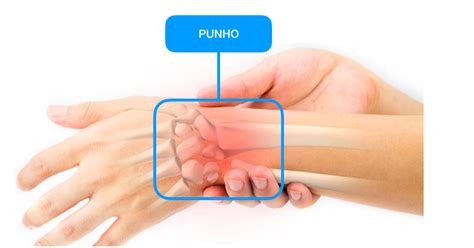Punho ou Pulso Qual o certo Medicina Ortopédica