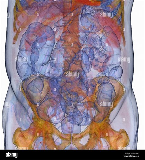 Ct Scan Abdomen Hi Res Stock Photography And Images Alamy