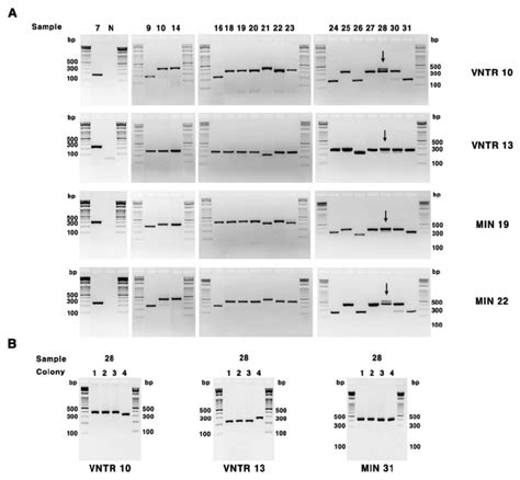 representative results of variable number tandem repeat vntr and download scientific diagram