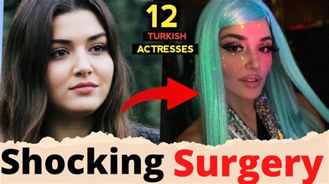Turkish Actresses Shocking Transformation Before And After Surgery