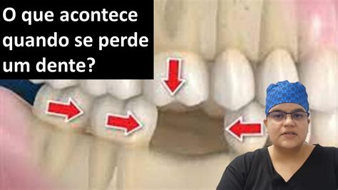 O que acontece quando se perde um dente Dra Bianca Rosa Clínica