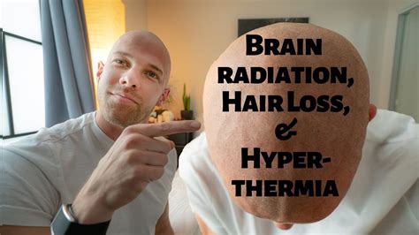 Episode Brain Radiation Hair Loss And Hyperthermia Treatment