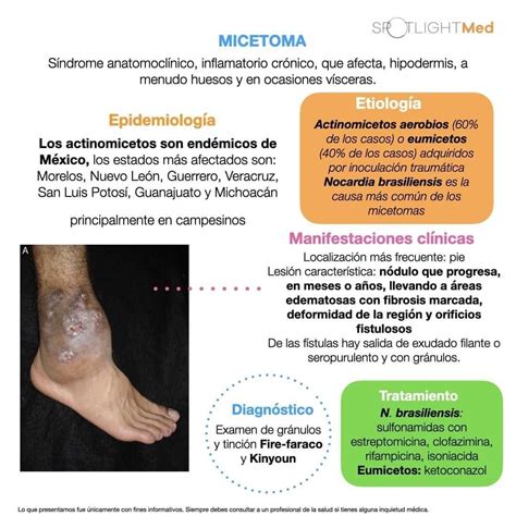 Micosis Superficiales Y Profundas 4 Manifestaciones Clinicas