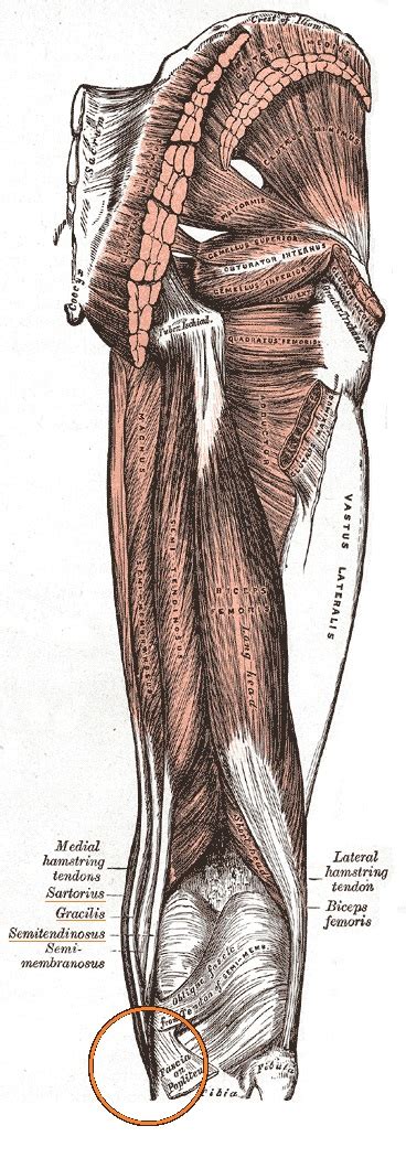 Pes Anserinus Bursitis Physiopedia