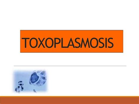 Toxoplasmosis JPaul HAsto UDocz