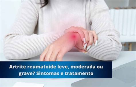 Artrite Reumatoide Leve Moderada Ou Grave Sintomas E Tratamento