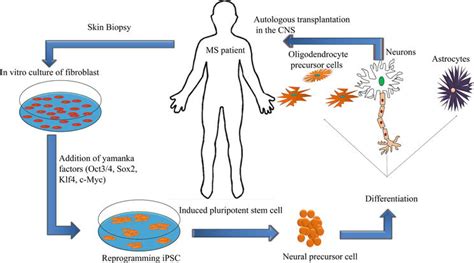 Stem Cell Therapy And Regenerative Medicine In Autoimmune Diseases