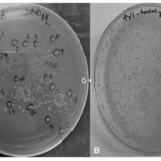 Plates Showing Colonies Of S Epidermidis Isolates Grown On TSA Medium
