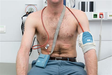Monitorización Ambulatoria De Presión Arterial Cardiología Deportiva