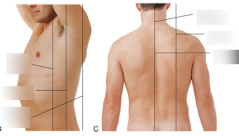 Midscapular Line