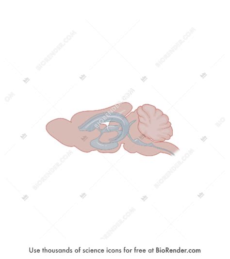 Sagittal Brain Ventricles