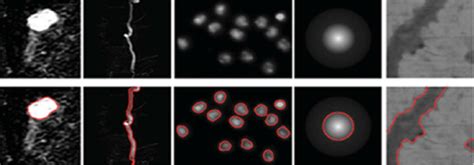 segmentation results of active contour on five images with blurred download scientific diagram