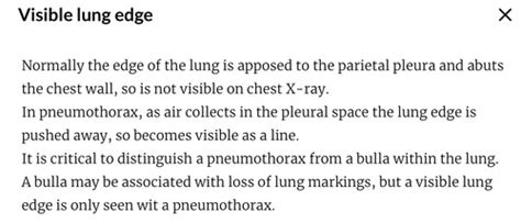 Pleuritic Chest Pain Interpreting Chest X Rays Flashcards Quizlet