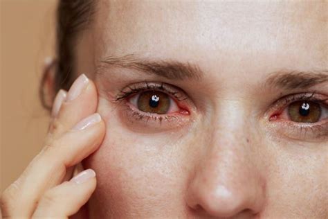 A qué se debe el dolor por pinchazos en los ojos Ocumed