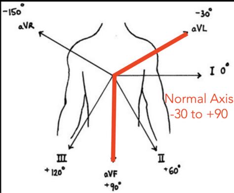 Ekg Basics Flashcards Quizlet