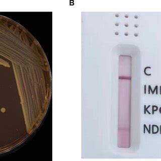 Identification Of An NDM Positive Escherichia Hermannii A The Colony