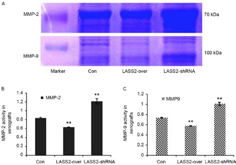 Gelatin Zymography Analysis Of The Activities Of Mmp And Mmp In The