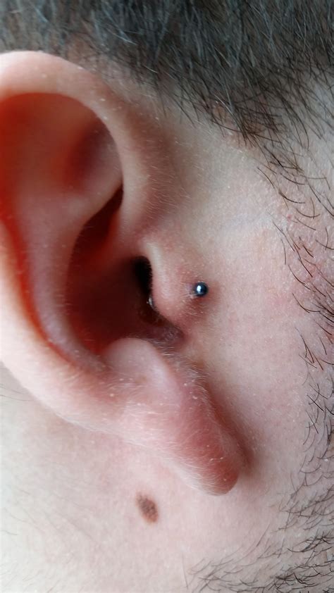 Swollen Tragus Piercing
