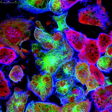 Confocal