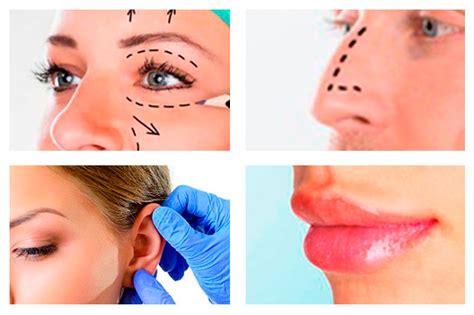 Top Tratamientos De Cirug A Est Tica Facial Dr Federico Rehberger