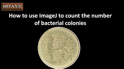 how to use imagej software to count the number of bacterial colonies youtube