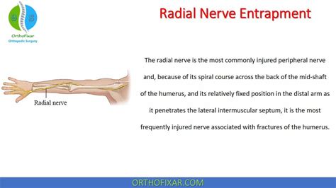 Superficial Radial Nerve Entrapment