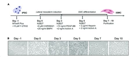 Differentiation Timeline Of IPSCs Into ISMCs A Schematic Of The