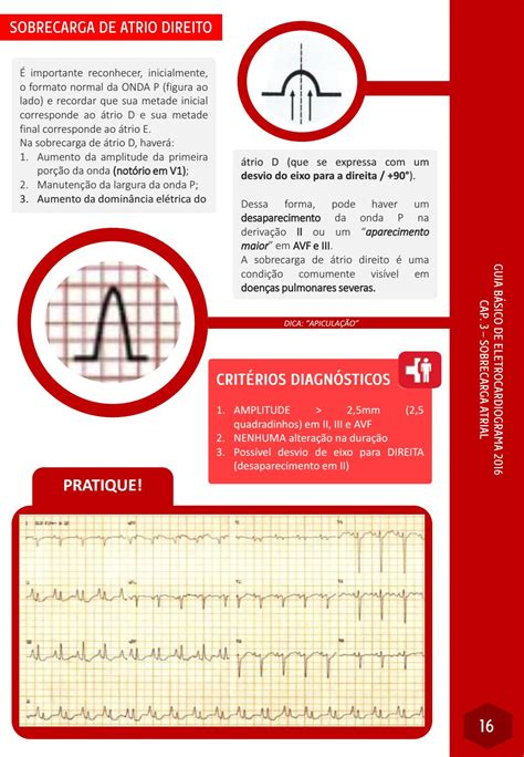GUIA BÁSICO DE ECG 2016 LIMACS by LIGA MÉDICO ACADÊMICA DE