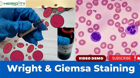 Jorsen Wright Stain Procedure Lab