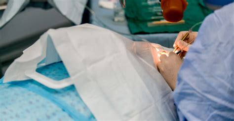 Laser prostate surgery Dr César Reyes
