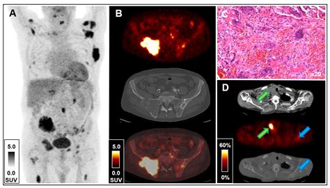 Diagnostics Free Full Text Molecular Imaging With 18F FDG PET CT