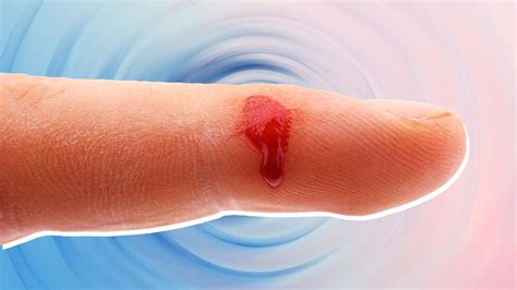Comment Reconna Tre Et Traiter Une Coupure Infect E L Actu Sant