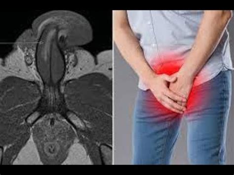 UK Man Is First To Break His Penis Vertically And More CRAZY News