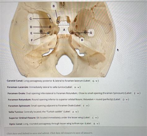 Cranial Floor View Labeled Viewfloor Co