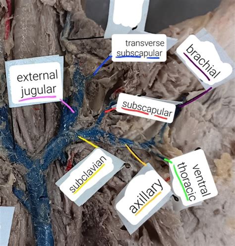 Anatomy Physiology Ii Lab Final Supplemental Study Guide Flashcards
