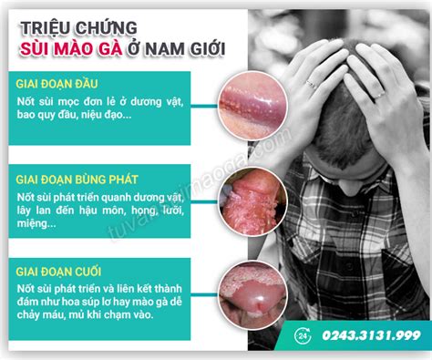 Nam Gi I Ph T Hi N C C Th T C Quan Sinh D C N N I U Tr Ngay