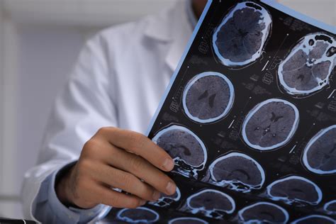 Día Mundial del Alzheimer 2023 La AEI destina más de 31 millones de