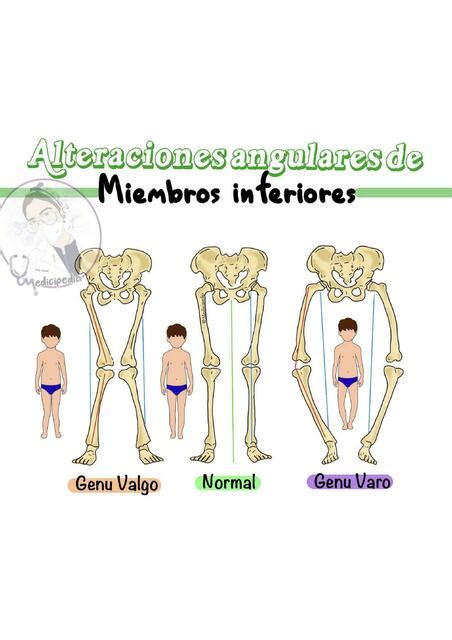 Alteraciones Musculares Miembros Inferiores Medicipedia UDocz