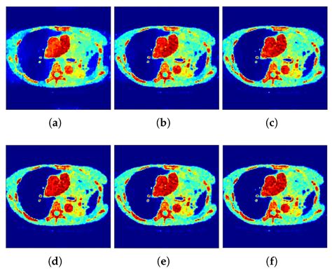 tomography free full text a novel iterative mlem image reconstruction algorithm based on