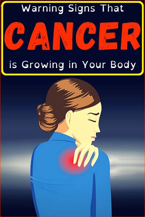 Early Warning Signs That Cancer Is Growing In Your Body
