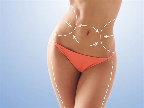 Vaser Liposuction A Better Approach To Achieve Expecting Goals