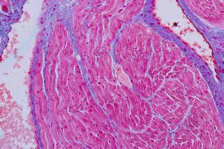 Education Anatomy And Histological Sample Heart Muscle Tissue Under The