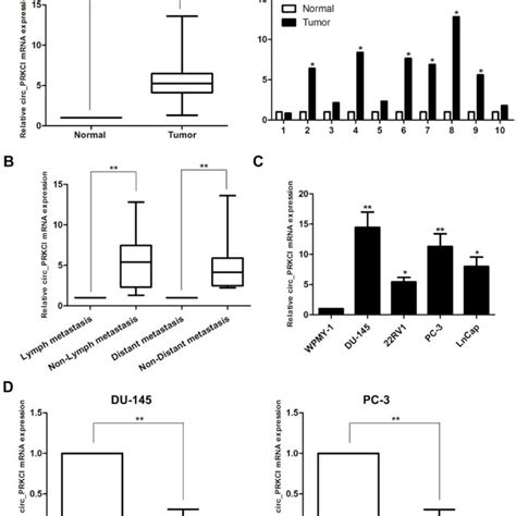 Circ PRKCI Triggered Proliferative And Metastatic Potentials Of PCa