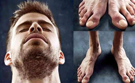Los pies más feos de los futbolistas en el mundo El HIT GUATE RADIO
