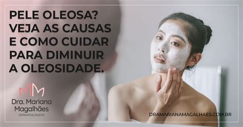 Pele Oleosa Veja As Causas E Como Cuidar Para Diminuir A Oleosidade