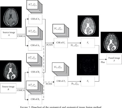 figure 2 from morphological component analysis based perceptual medical image fusion using
